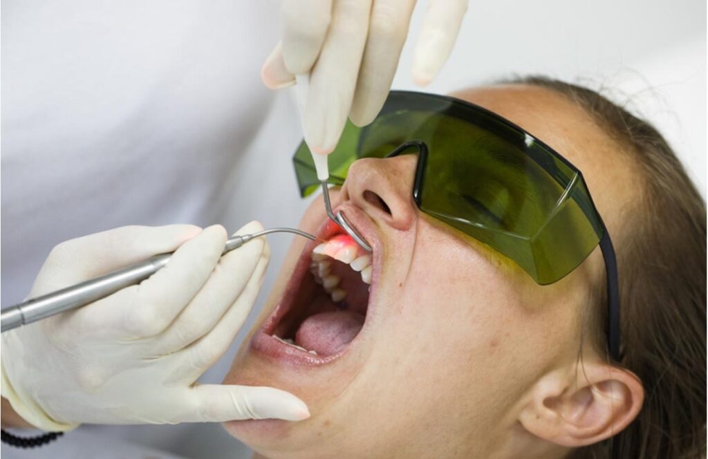 Conventional Gum Surgeries - Sree Balaji Dentals